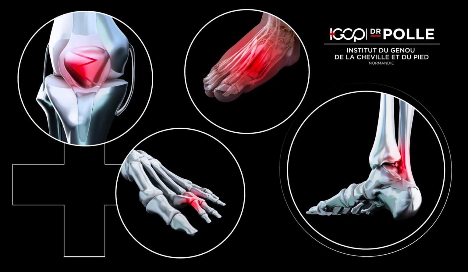 Les pathologies : consultation orthopédiste | Dr Polle | Bois-Guillaume