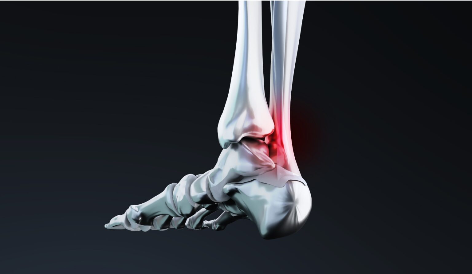 Peignage du tendon d'Achille et PRP | Bois-Guillaume | Dr Polle